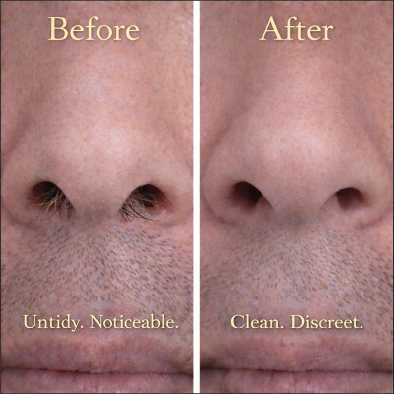 Lumero Nose Hair Trimmer